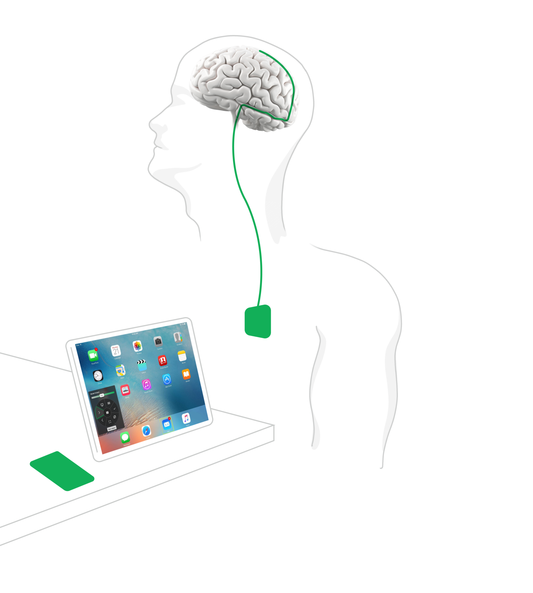 Synchron hooks up human brain direct to AI - Forbes Australia