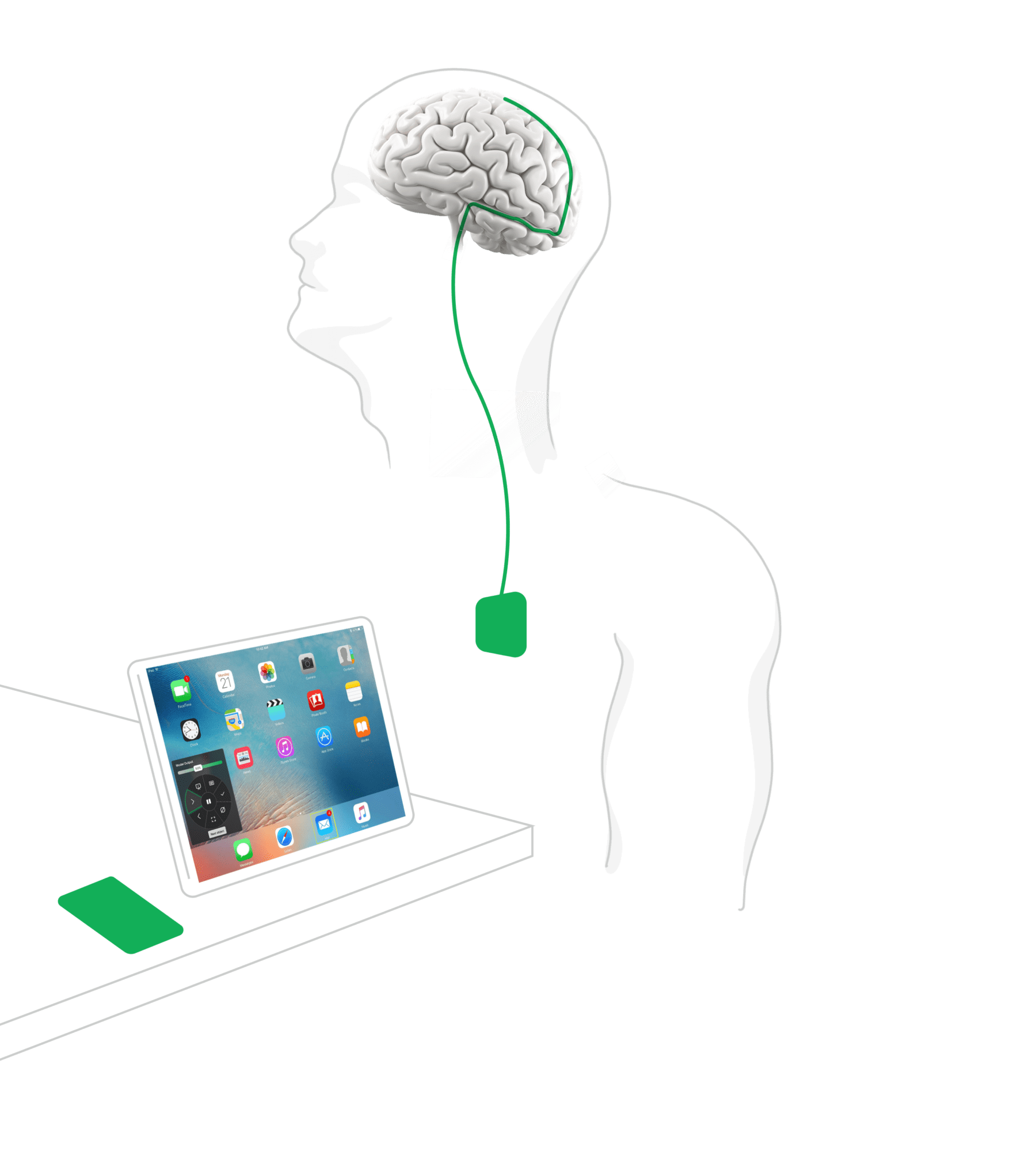 Synchron hooks up human brain direct to AI - Forbes Australia